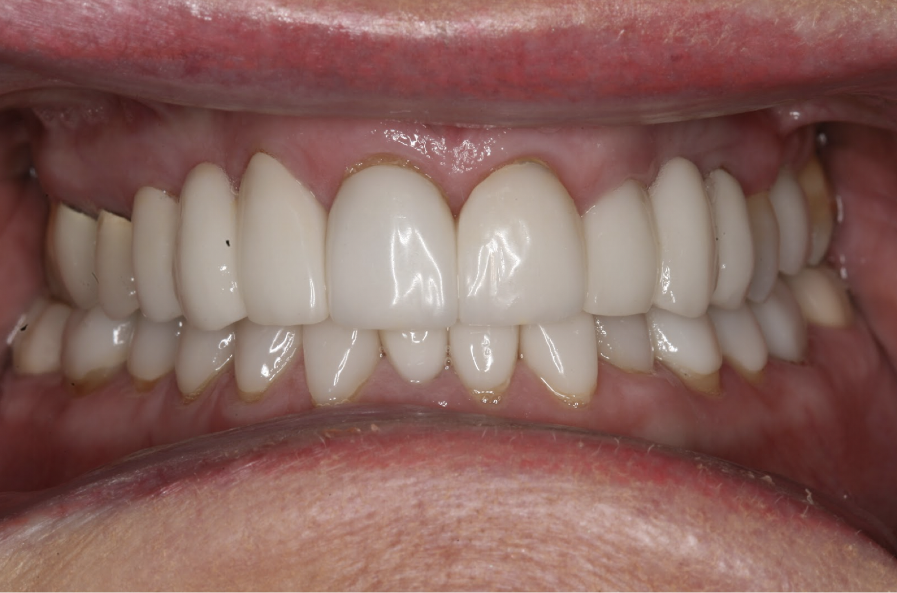 I need some help with this treatment plan!! - Spear Talk