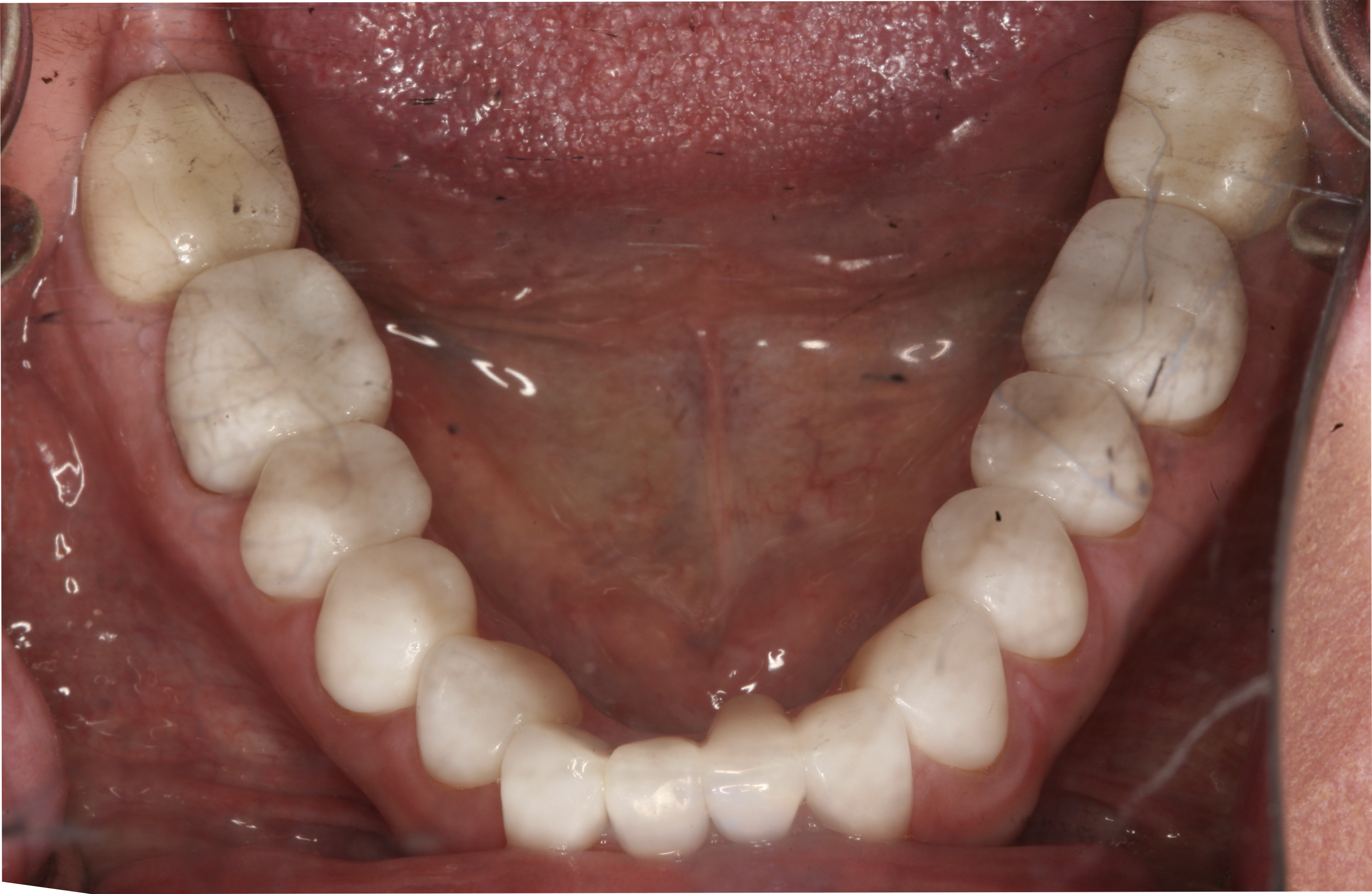 I need some help with this treatment plan!! - Spear Talk