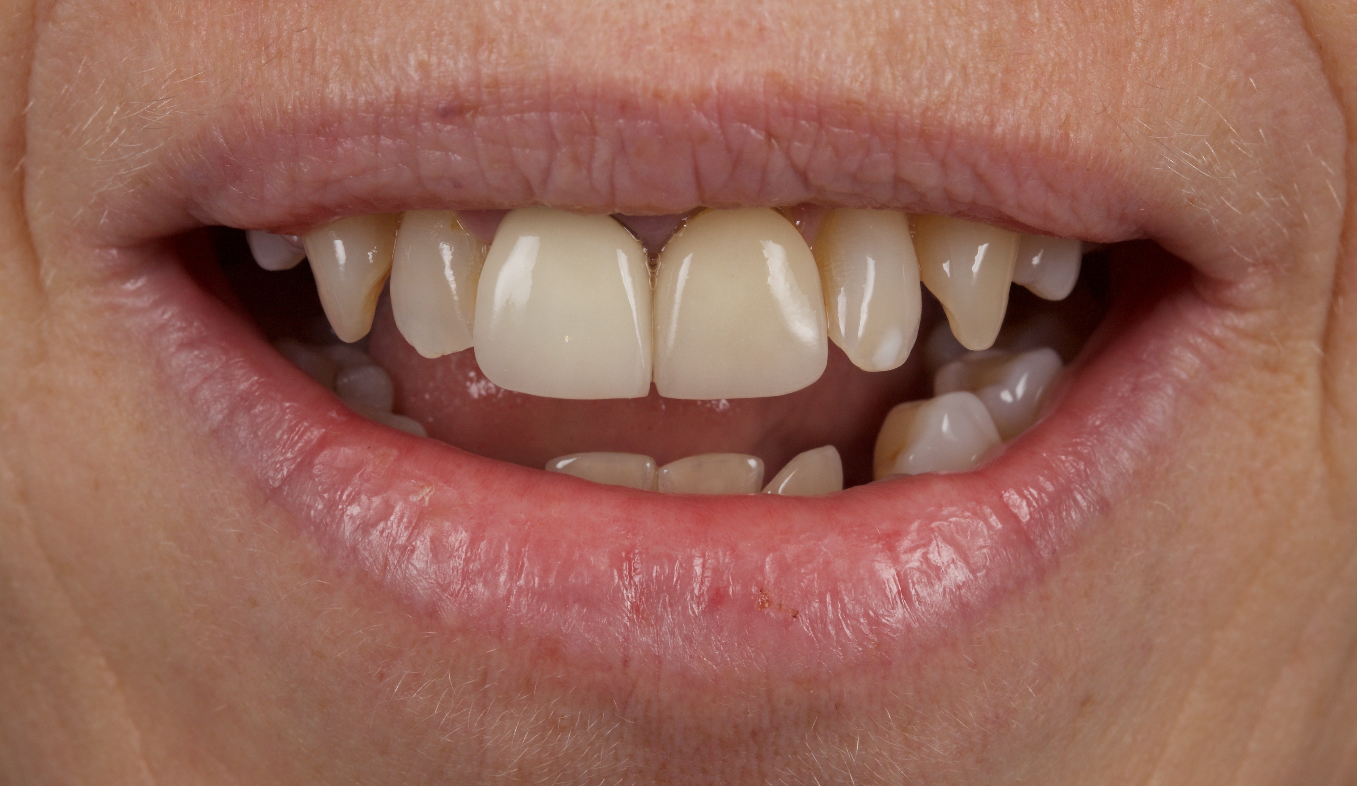 Natural Aesthetics Vs Cosmetics - Spear Talk