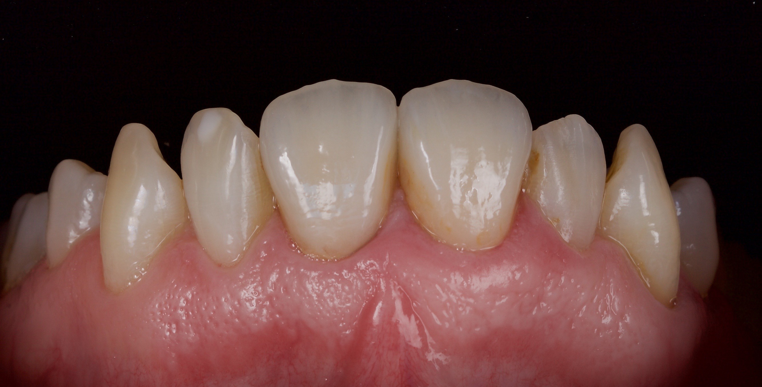 Natural Aesthetics Vs Cosmetics - Spear Talk