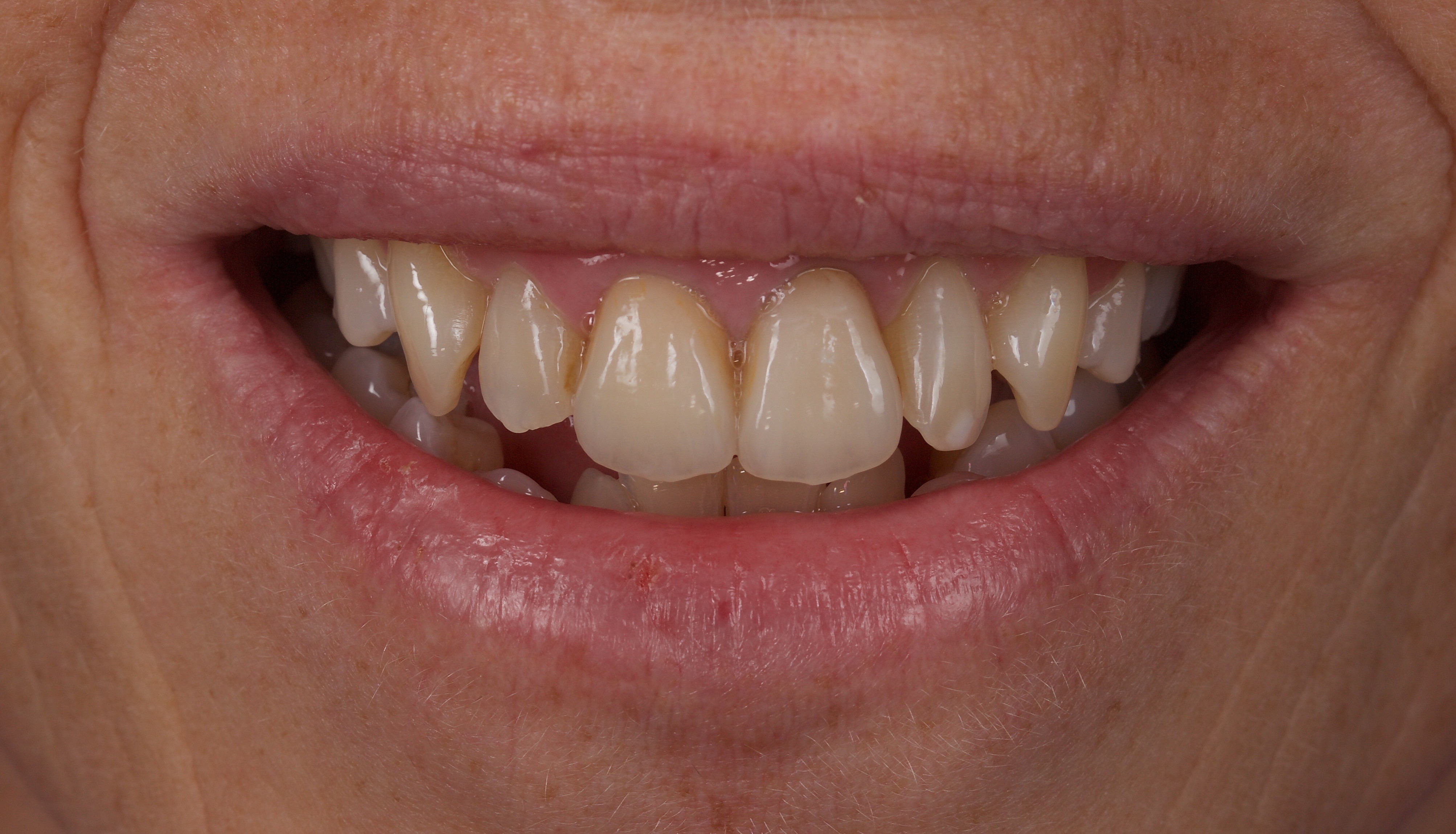 Natural Aesthetics Vs Cosmetics - Spear Talk