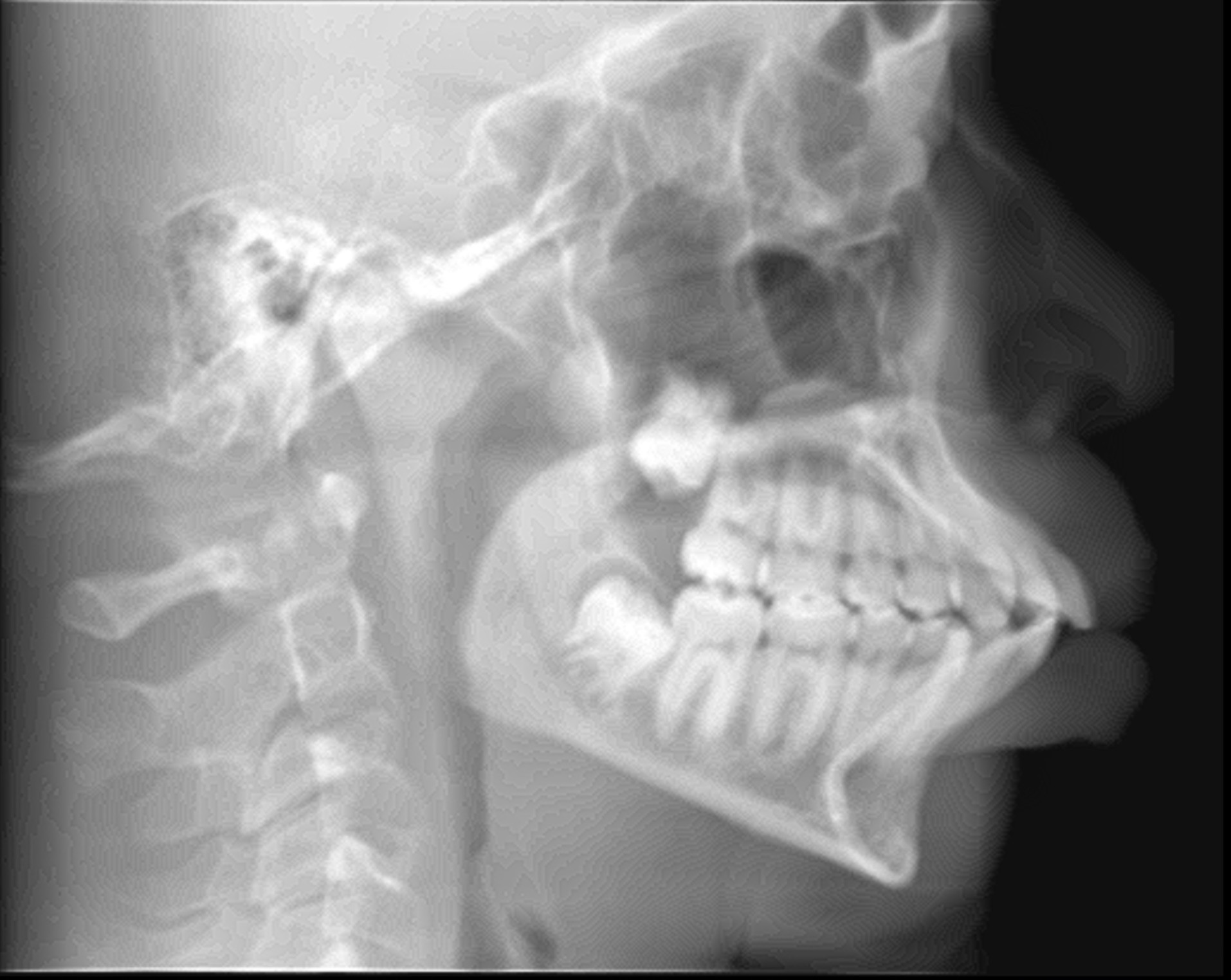 How my Ortho Planning as changed... - Spear Talk