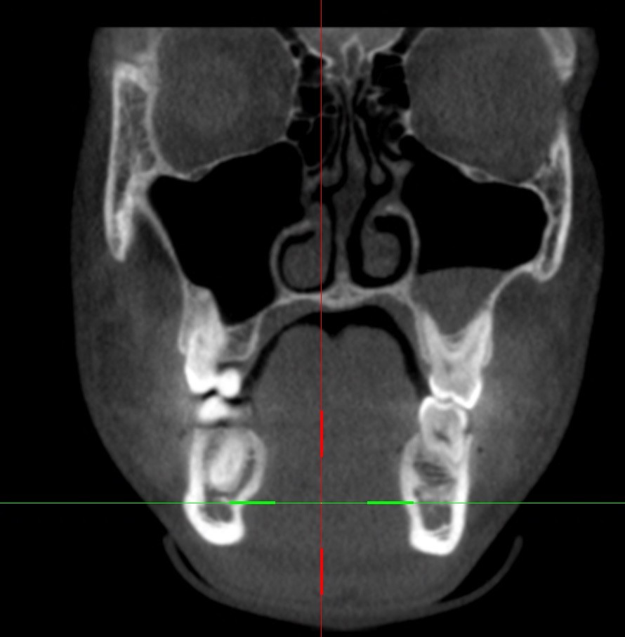 How my Ortho Planning as changed... - Spear Talk