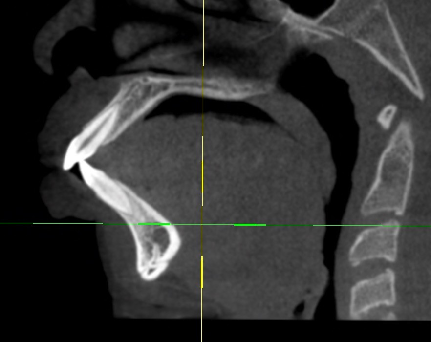 How my Ortho Planning as changed... - Spear Talk