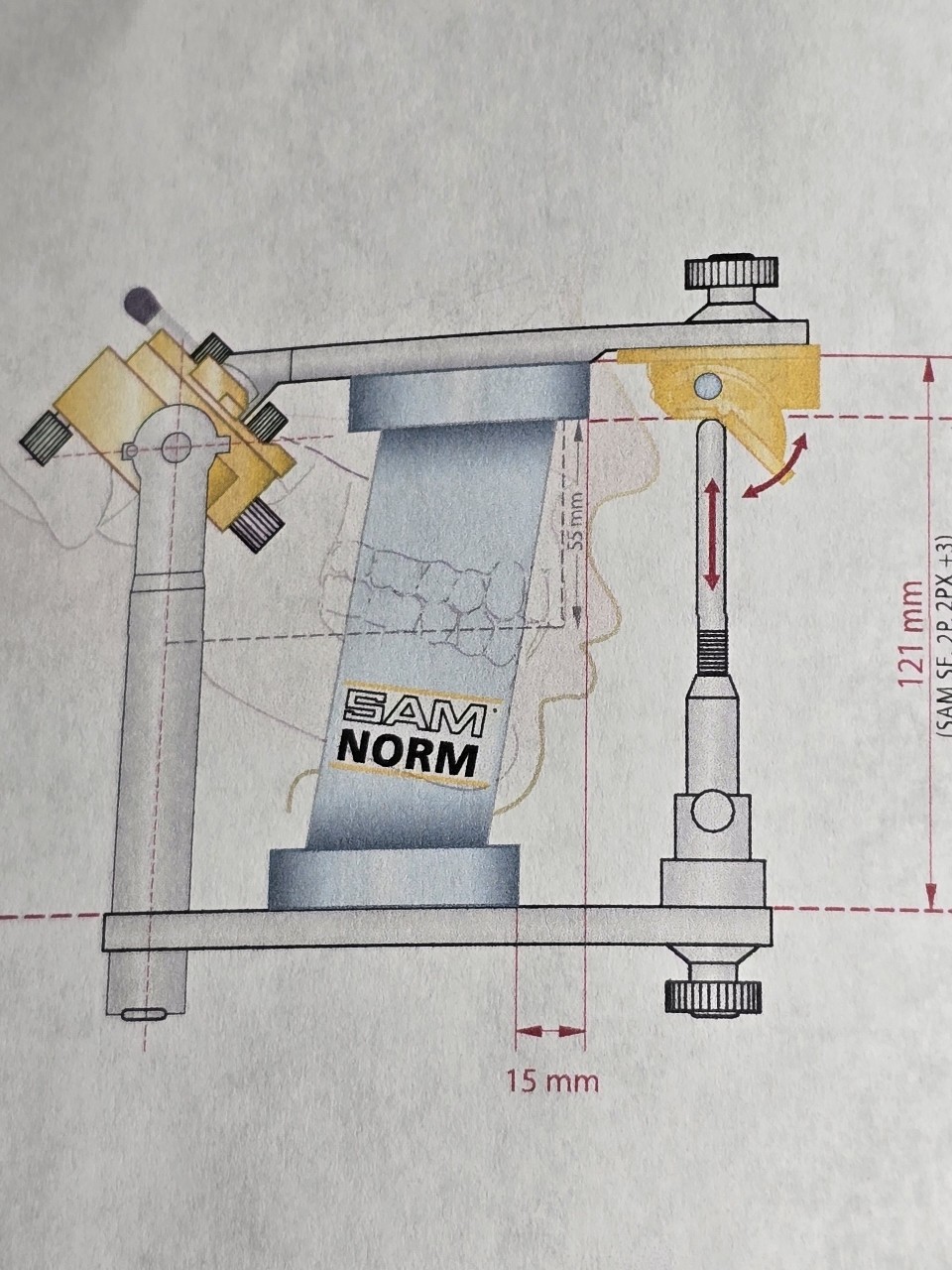 Facebow and the lab??? What to do - Spear Talk