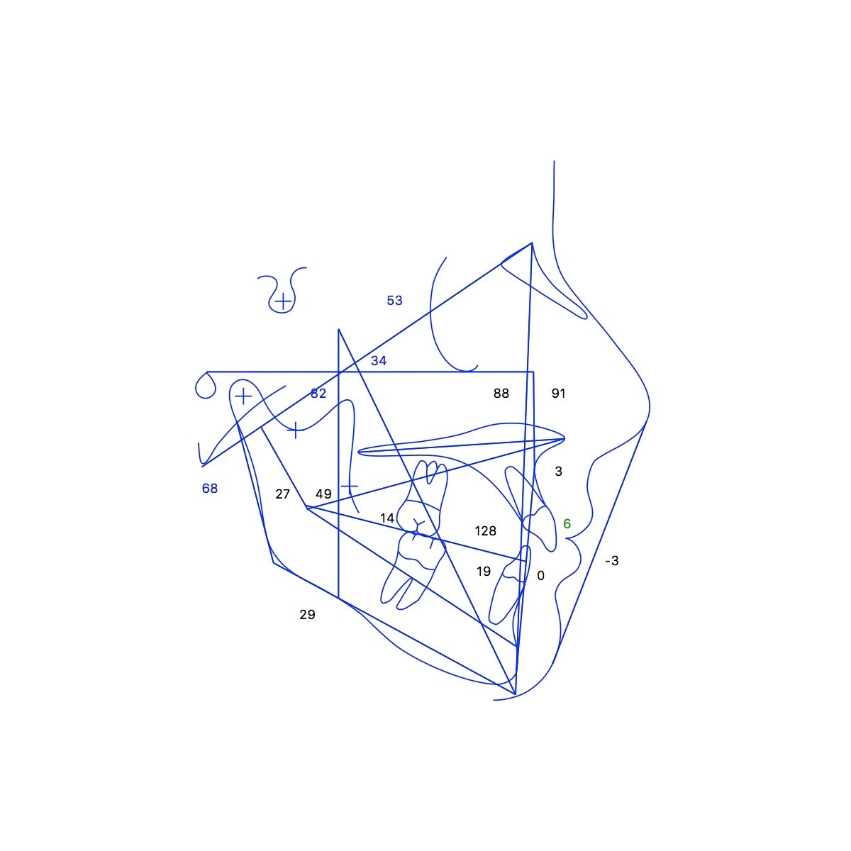 What caused this ortho relapse? - Spear Talk