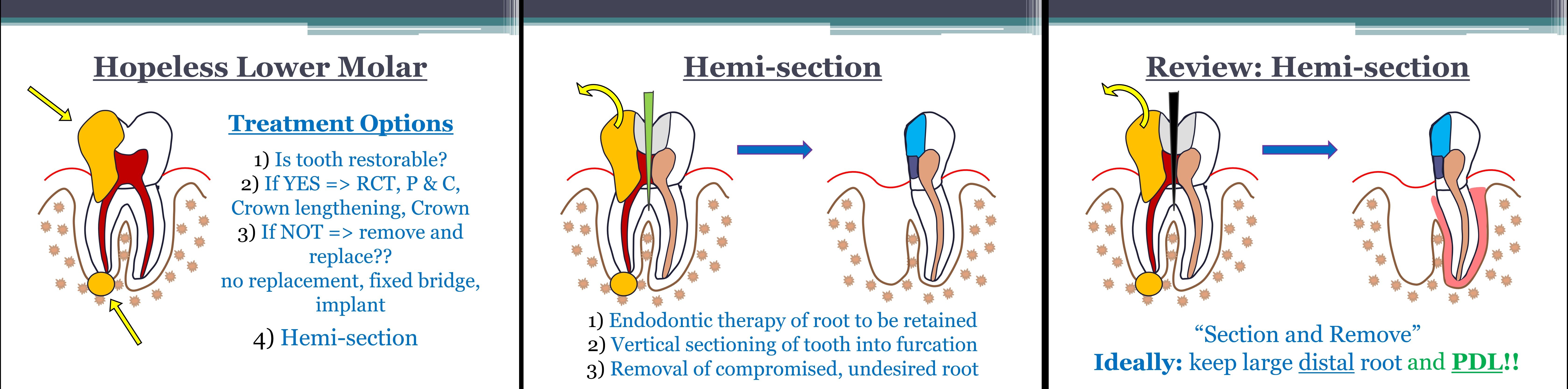 Restorative docs, where do you draw the line? - Spear Talk