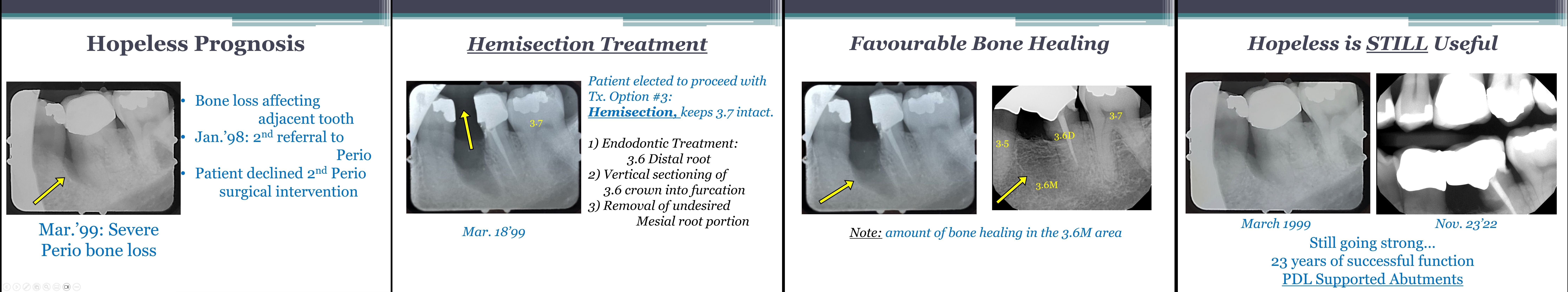 Restorative docs, where do you draw the line? - Spear Talk