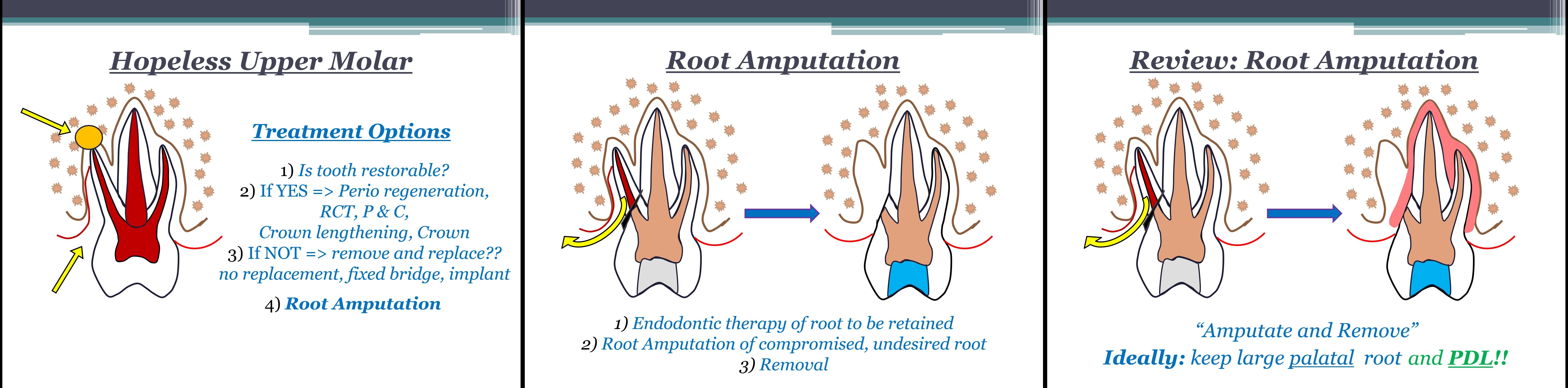 Restorative docs, where do you draw the line? - Spear Talk