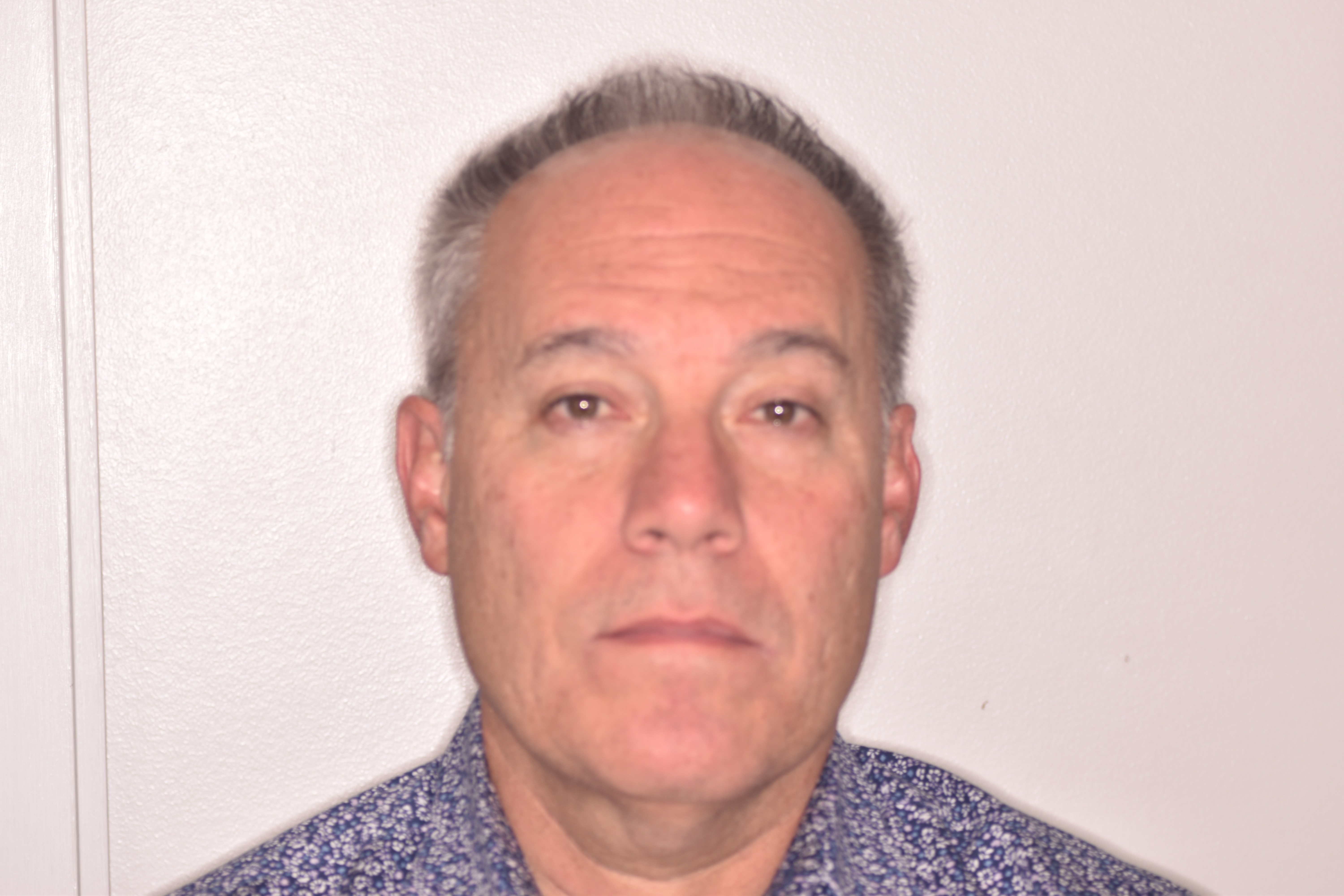 CO/CR slide and Orthodontic treatment - Spear Talk