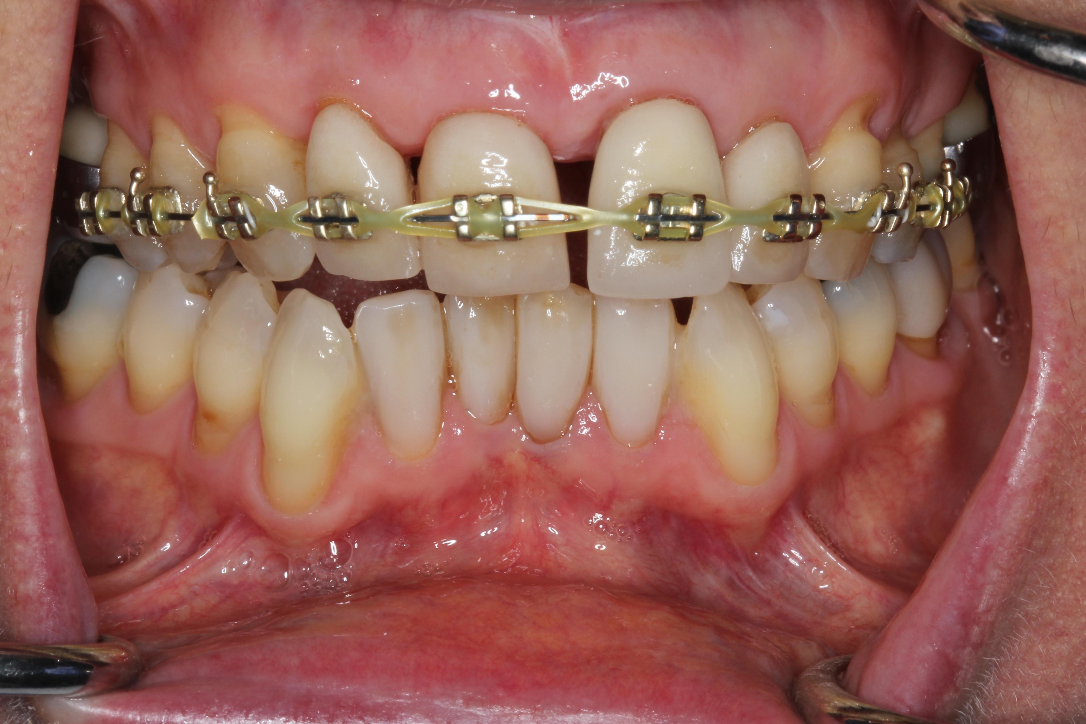 Ongoing Interdisciplinary Case Pt. 3 - Spear Talk